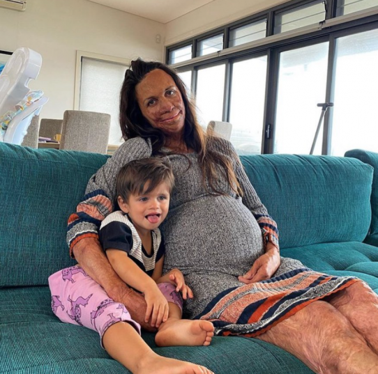 Why Turia Pitt Is One Of Australia's Most Inspirational Women - Mama ...